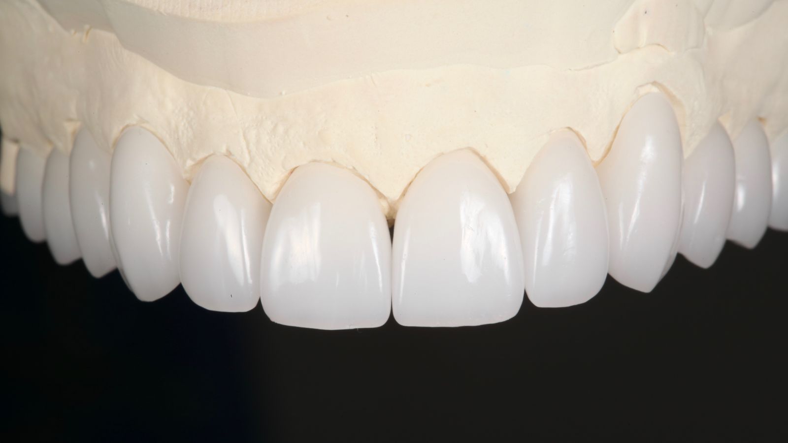 In-House Lab - William C. Strupp DDS and Michael W. Brumm DMD ...